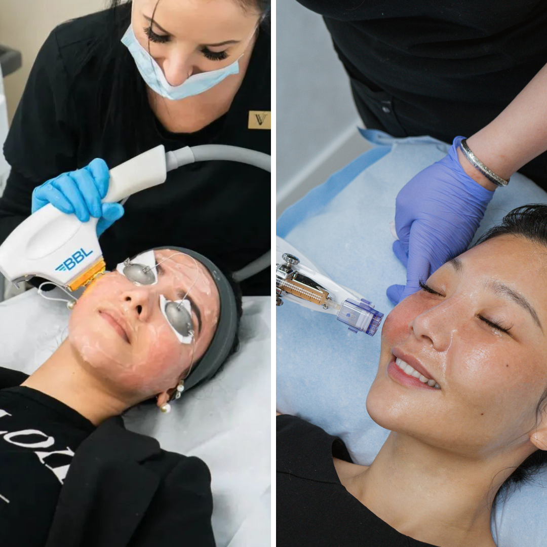 HydraGlow™ Bundle – Vancouver Laser & Skin Care Centre