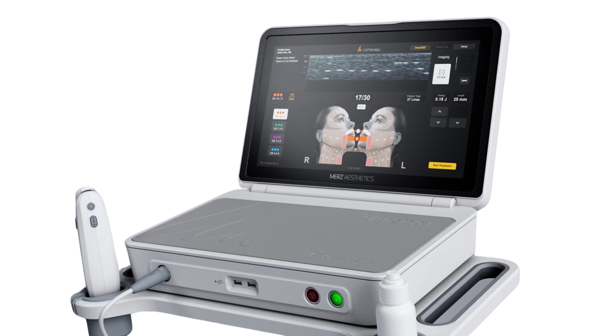 Ultherapy PRIME at Vancouver Laser – Vancouver Laser & Skin Care Centre